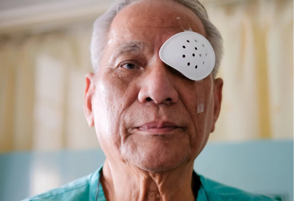 Cataract Appointment - Opticians in Merry Hill | Eye Tests & Glasses ...
